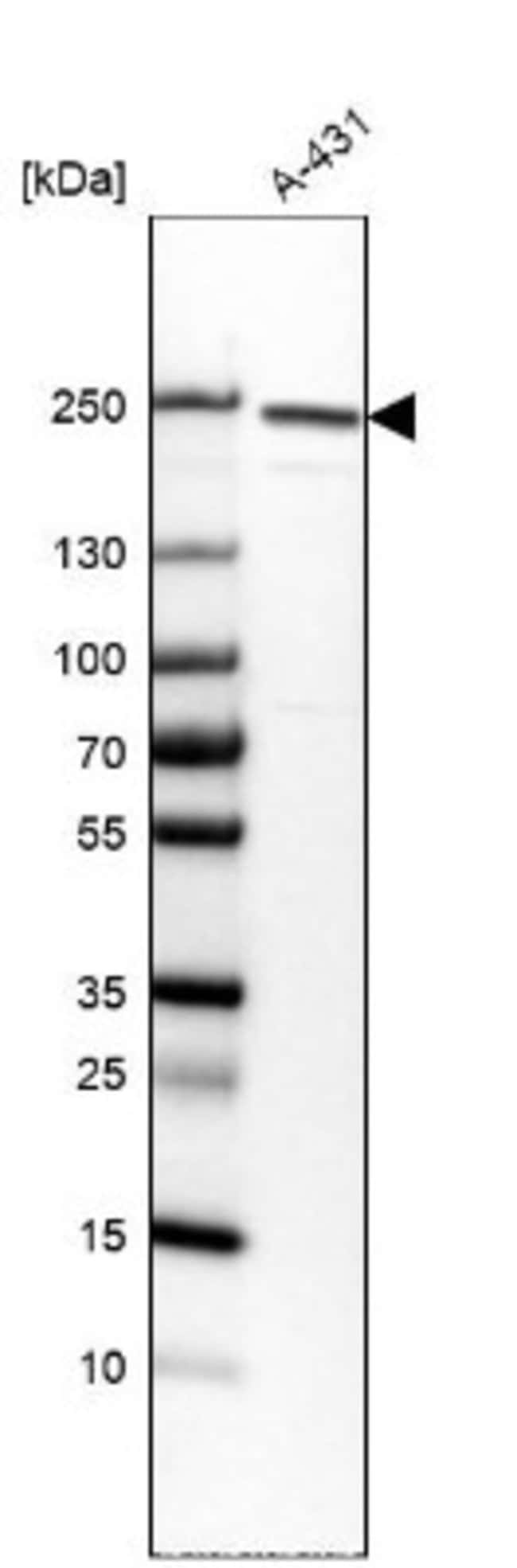 Integrin beta 4/CD104 Antibody (CL6973), Novus Biologicals™ Integrin ...