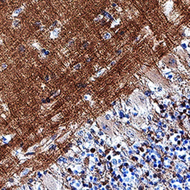 Human L1CAM Antibody:Antibodies:Primary Antibodies | Fisher Scientific