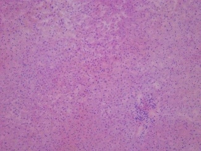 Novus Biologicals Liver Tissue Slides (Diabetes)- Frozen Quantity: 5 ...