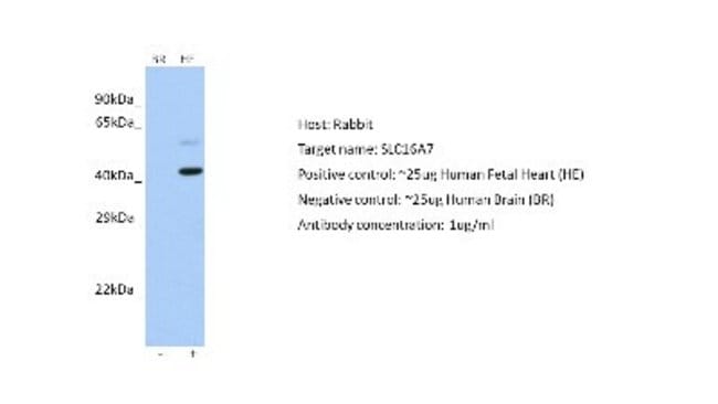 MCT2 Rabbit anti-Human, Polyclonal, Novus Biologicals 0.1ml ...