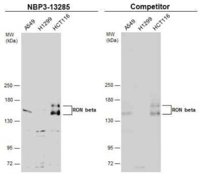 MSPR/Ron Beta Antibody, Novus Biologicals 100 μg; Unconjugated ...