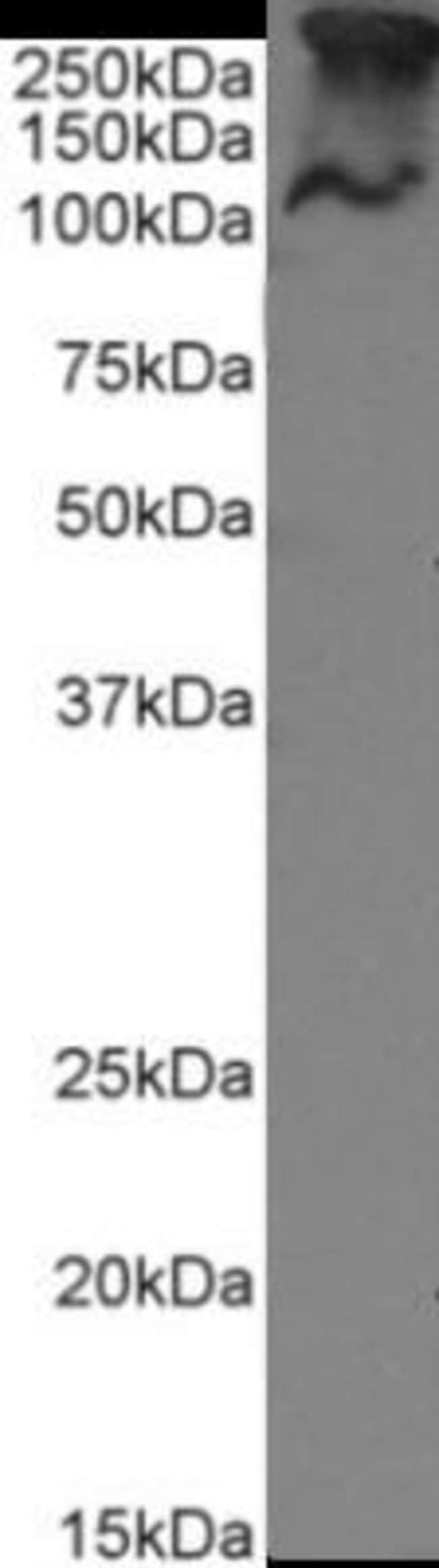 MUC1 Rabbit anti-Human, Clone: SM3, Novus Biologicals 0.025 mg; Unconjugated:Antibodies ...