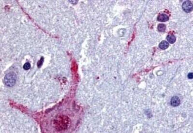 Muscarinic Acetylcholine Receptor M3/CHRM3 Antibody - BSA Free, Novus ...