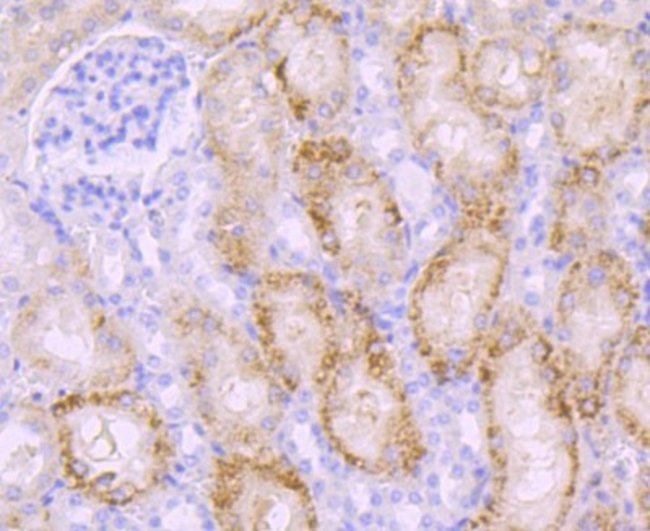 PKC BETA AB (JM43-26)-100 UL