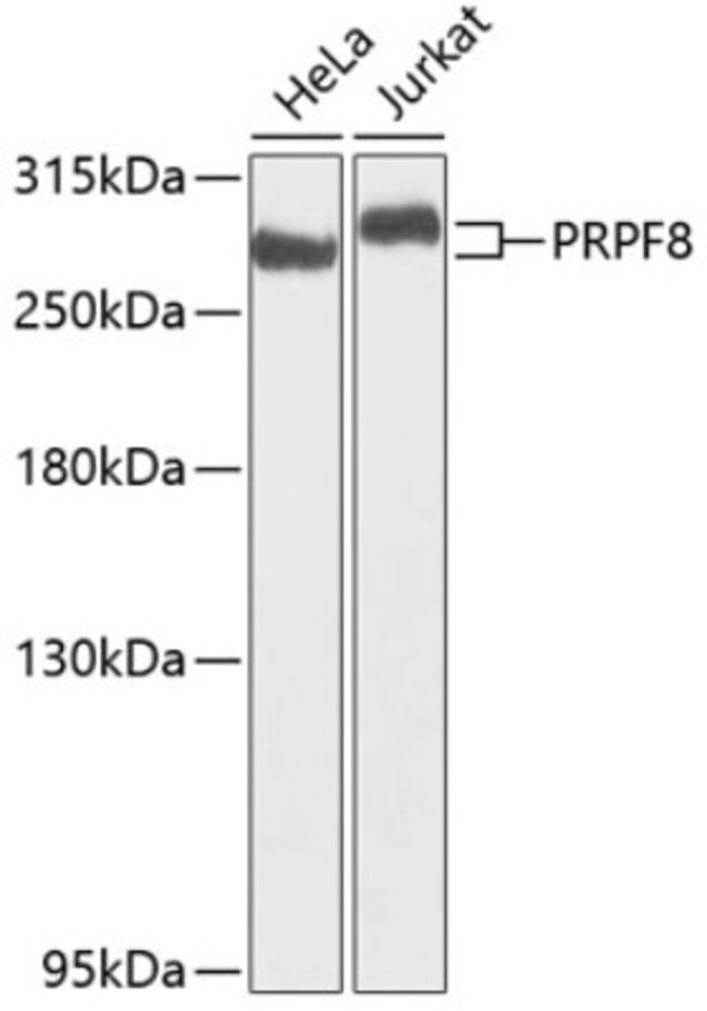 PRPF8 Rabbit anti-Human, Mouse, Rat, Polyclonal, Novus Biologicals 20 ...