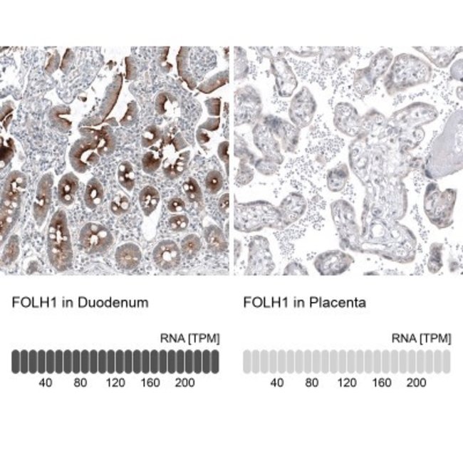 PSMA/FOLH1/NAALADase I Antibody (CL9089) 100 μL; Unconjugated ...