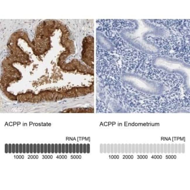Prostatic Acid Phosphatase Acpp Antibody Novus Biologicals™ 25 μl