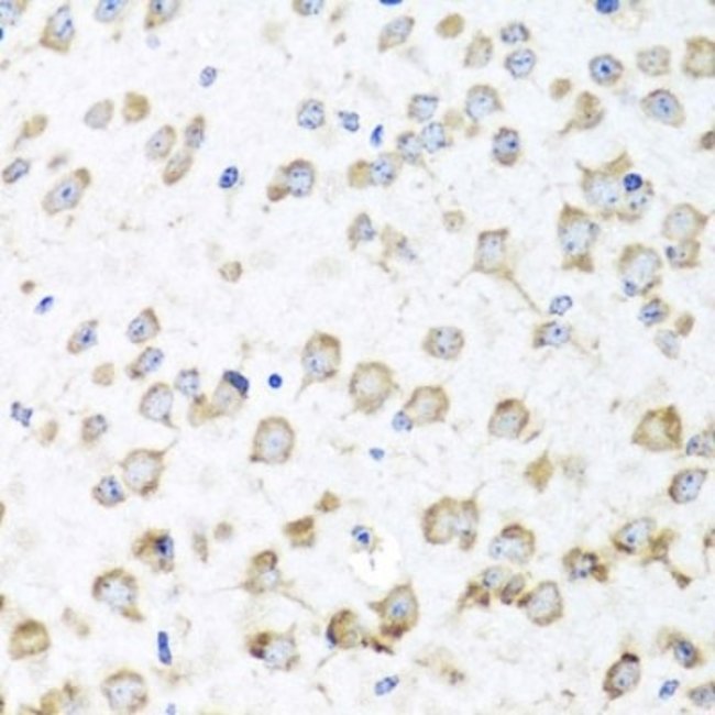 RPL36 Rabbit anti-Human, Mouse, Rat, Polyclonal, Novus Biologicals:Antibodies:Primary | Fisher ...