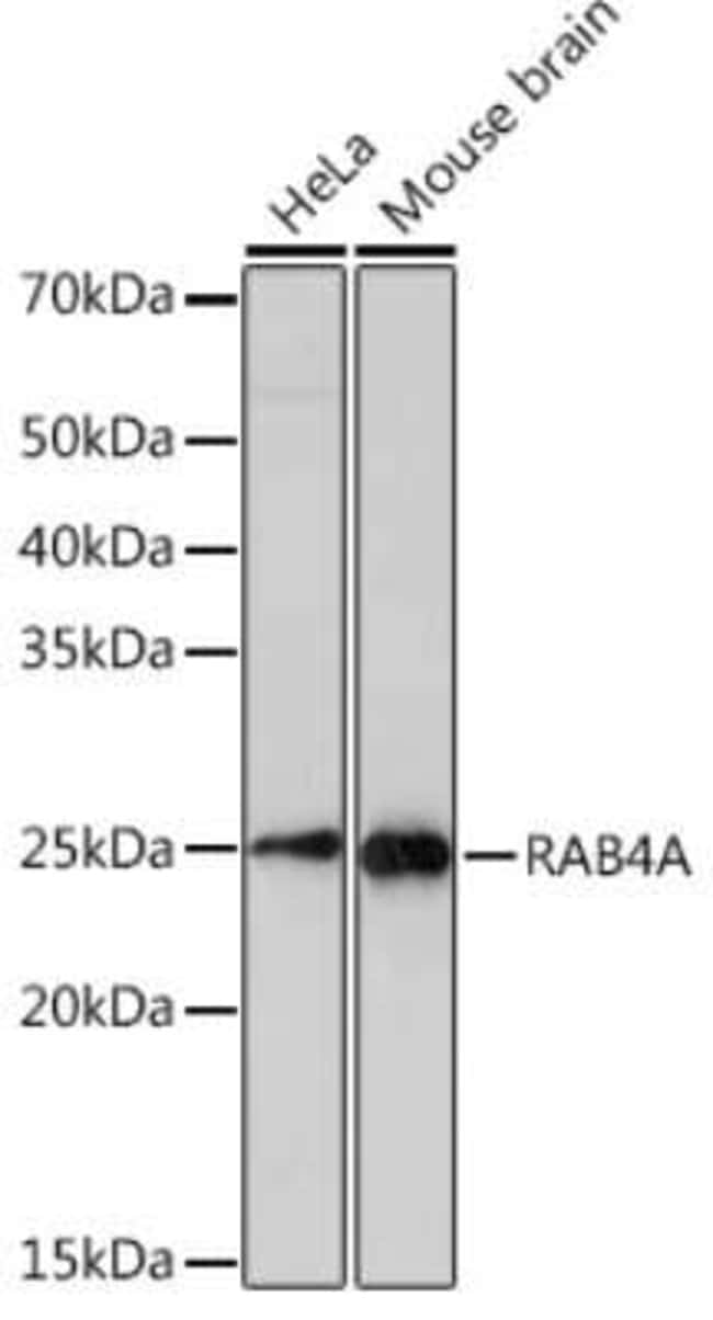 Rab4 Rabbit anti-Human, Mouse, Clone: 8I5K1, Novus Biologicals ...