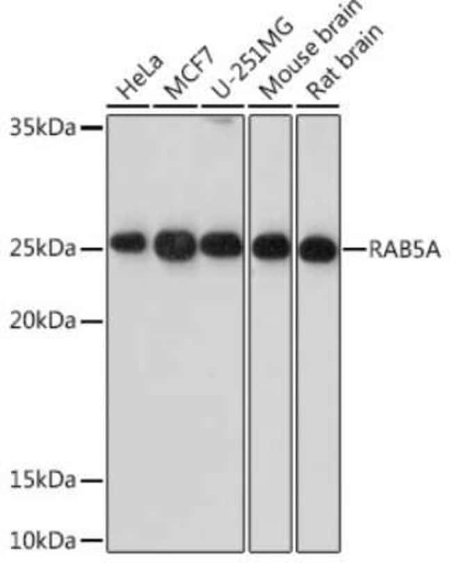 Rab5a Rabbit anti-Human, Mouse, Rat, Clone: 0K5J1, Novus Biologicals ...