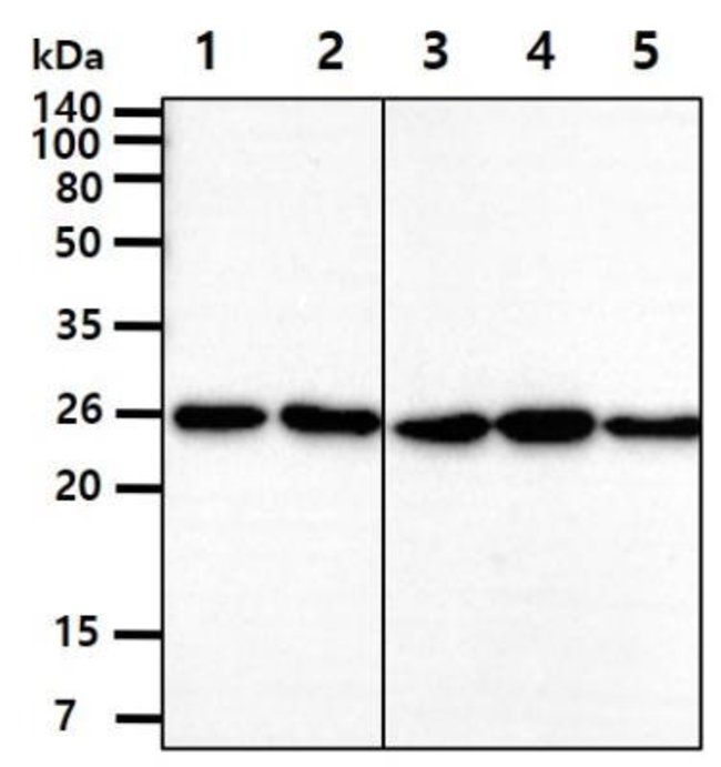 RALA/RALB (AT41E2) - 50 UL