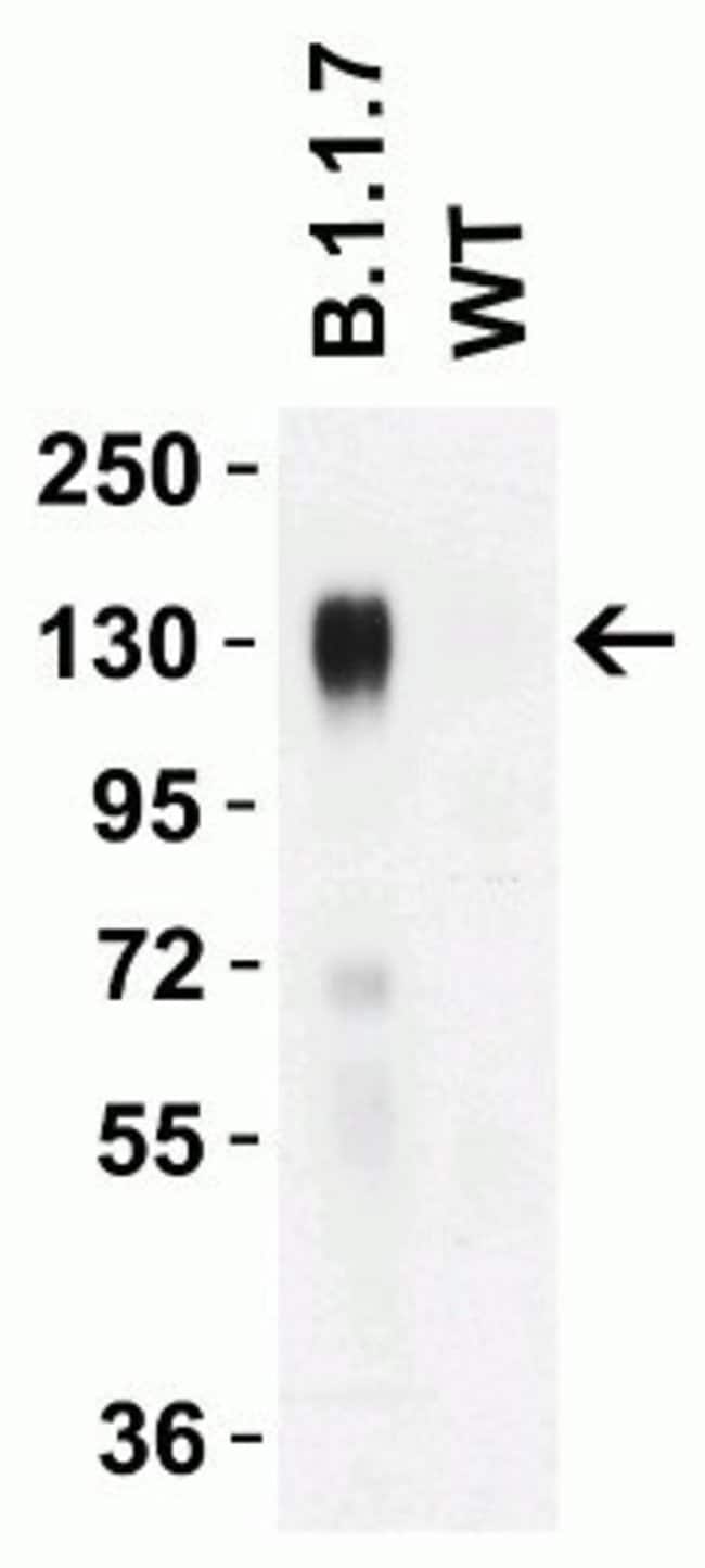 SARS-CoV-2 Spike Rabbit anti-SARS-CoV-2, Polyclonal, Novus Biologicals ...