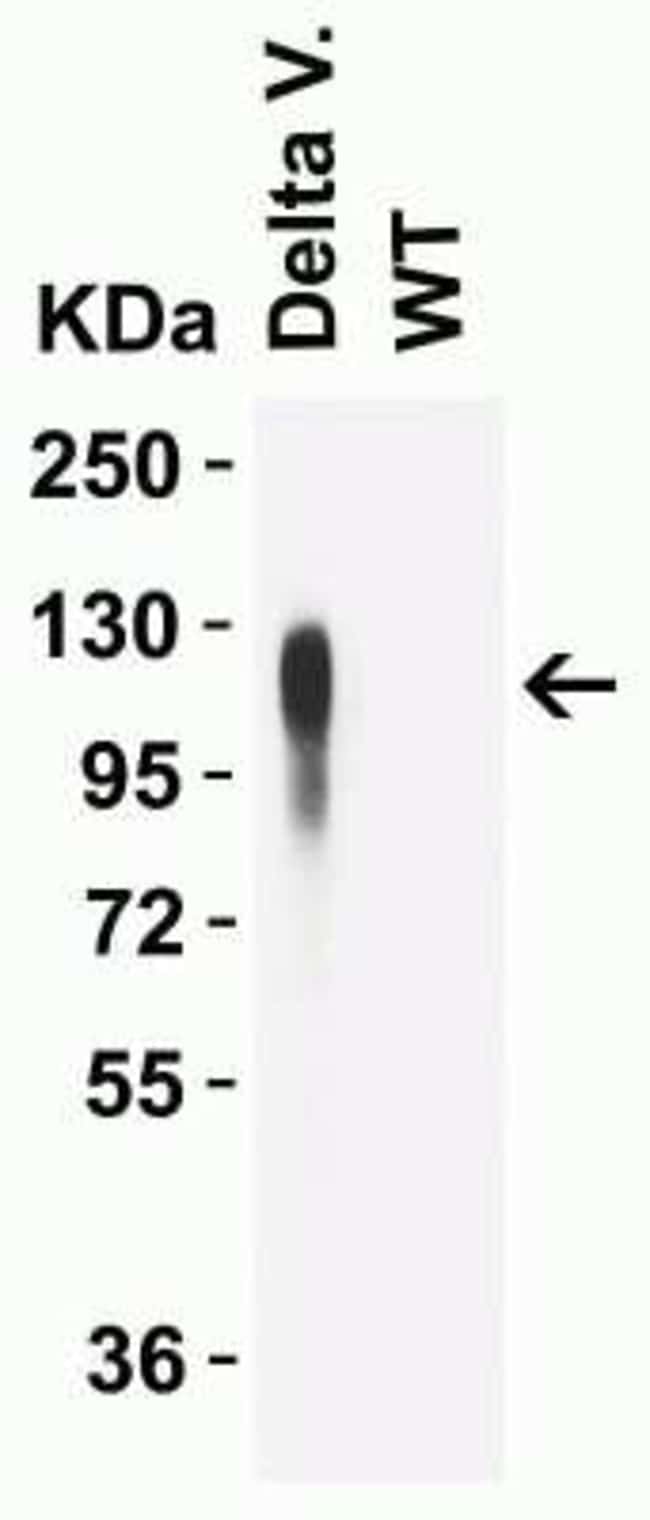 SARS-CoV-2 Spike Rabbit anti-SARS-CoV-2, Polyclonal, Novus Biologicals ...