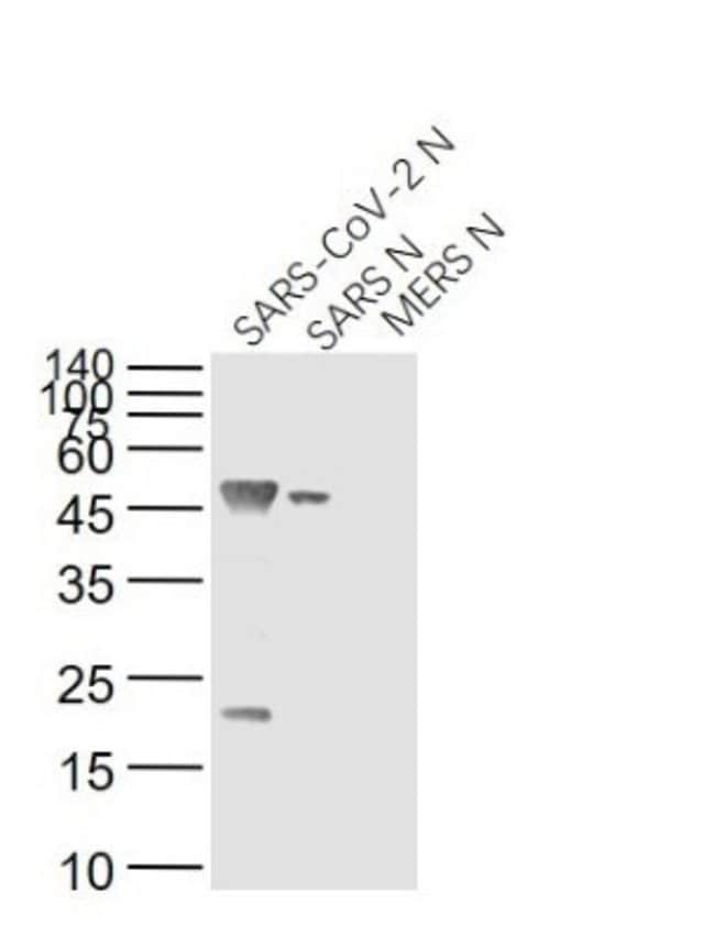 SARS Nucleocapsid Protein Antibody (8G8A) - Azide and BSA Free, Novus ...