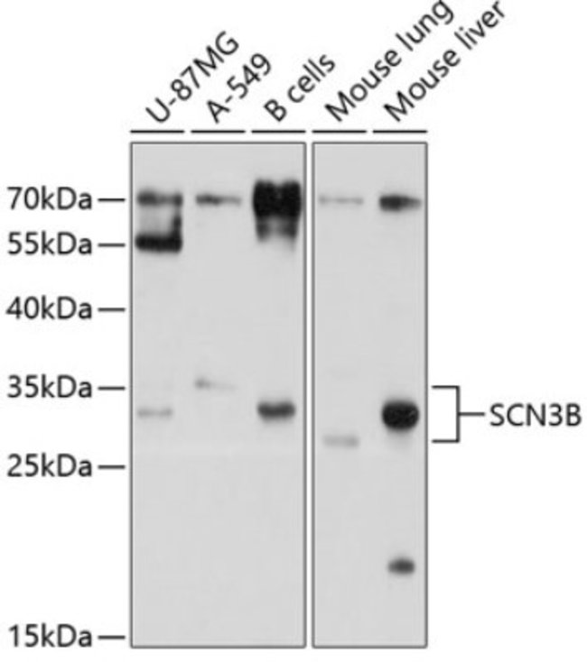 SCN3B Rabbit anti-Human, Mouse, Polyclonal, Novus Biologicals 100 μg ...