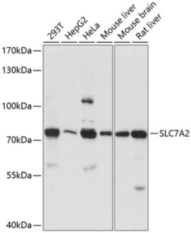SLC7A2 Rabbit anti-Human, Mouse, Rat, Polyclonal, Novus Biologicals 100 ...