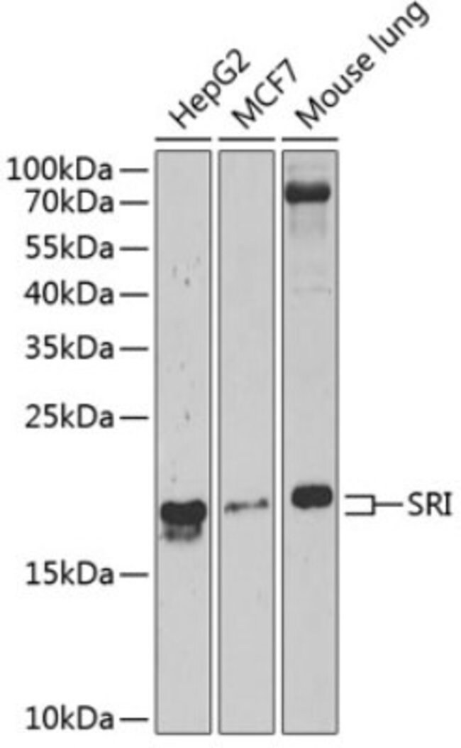 SR1 Rabbit anti-Human, Mouse, Rat, Polyclonal, Novus Biologicals 100 μg ...