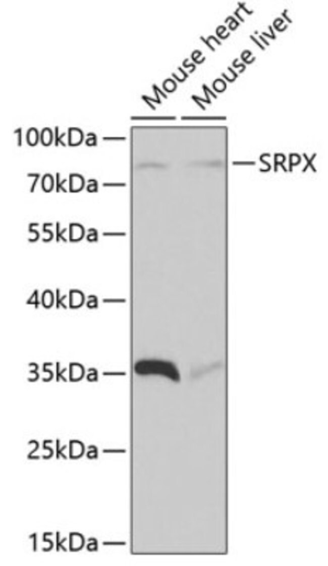 SRPX Rabbit anti-Human, Mouse, Polyclonal, Novus Biologicals 100 μg; | Fisher Scientific