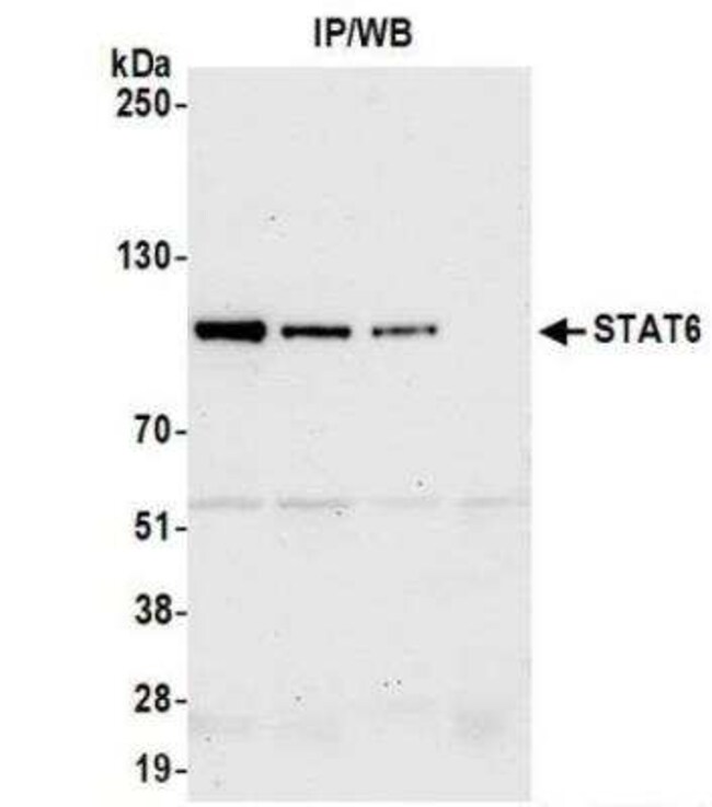 STAT6 Antibody (BLR147J), Novus Biologicals 100 μg; Unconjugated ...
