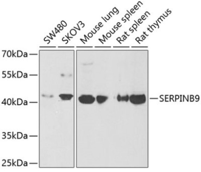 SerpinB9 Rabbit anti-Human, Mouse, Rat, Polyclonal, Novus Biologicals ...