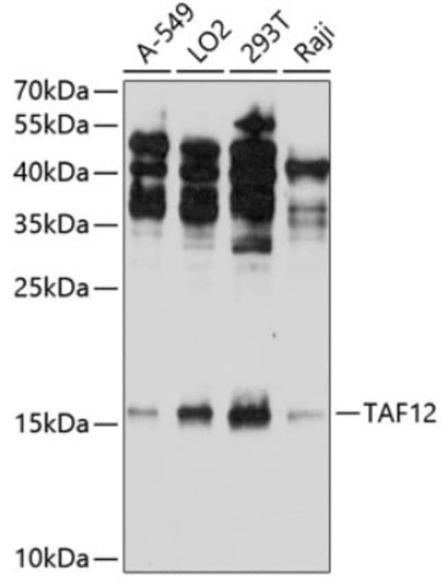 TAF12 Rabbit anti-Human, Rat, Polyclonal, Novus Biologicals 100 μg ...