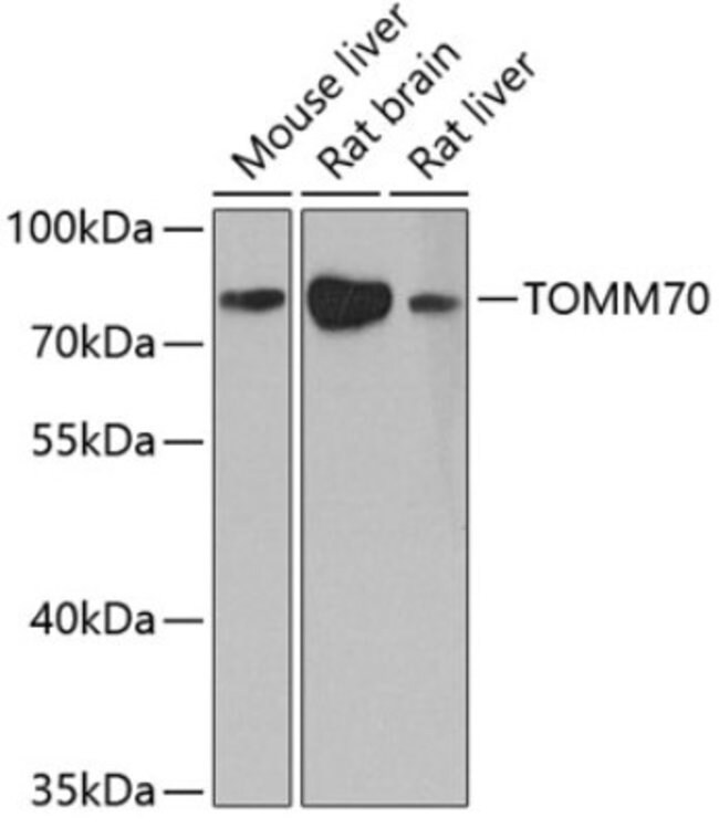 TOM70 Rabbit anti-Human, Mouse, Rat, Polyclonal, Novus Biologicals 100 ...