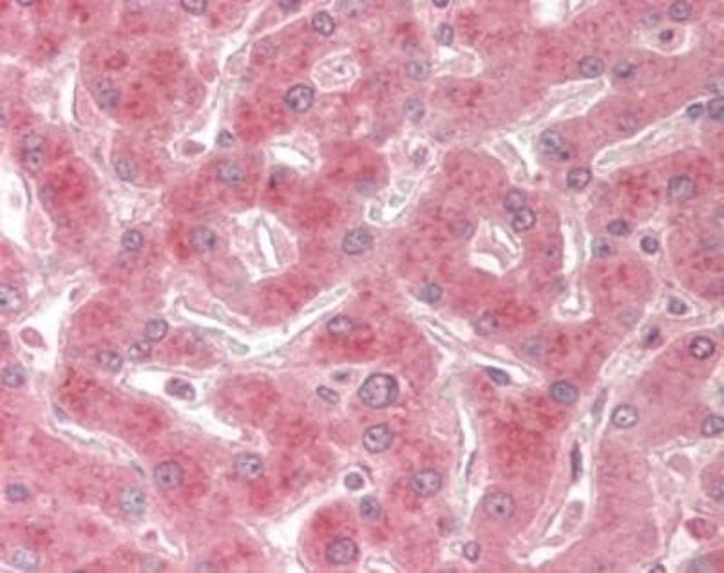 TRAILR2/TNFRSF10B, Mouse anti-Human, Clone: HS201, Novus Biologicals ...