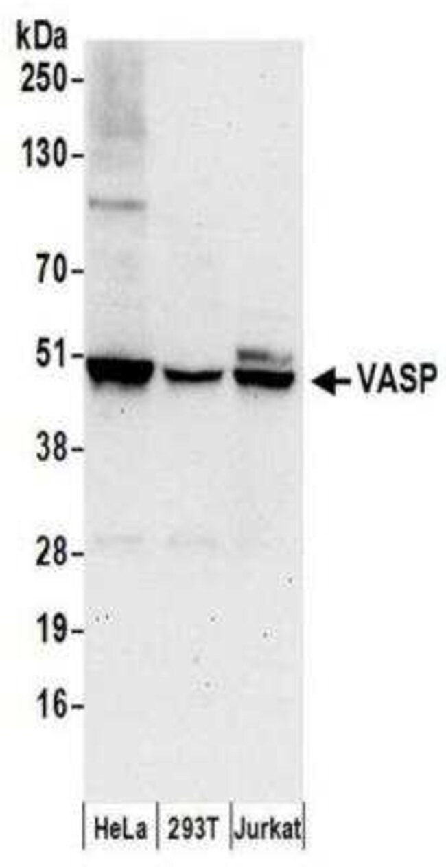 VASP Antibody, Novus Biologicals 100 μg; Unconjugated:Antibodies ...