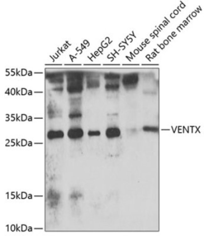 VENTX Rabbit anti-Human, Mouse, Rat, Polyclonal, Novus Biologicals:Antibodies:Primary | Fisher ...