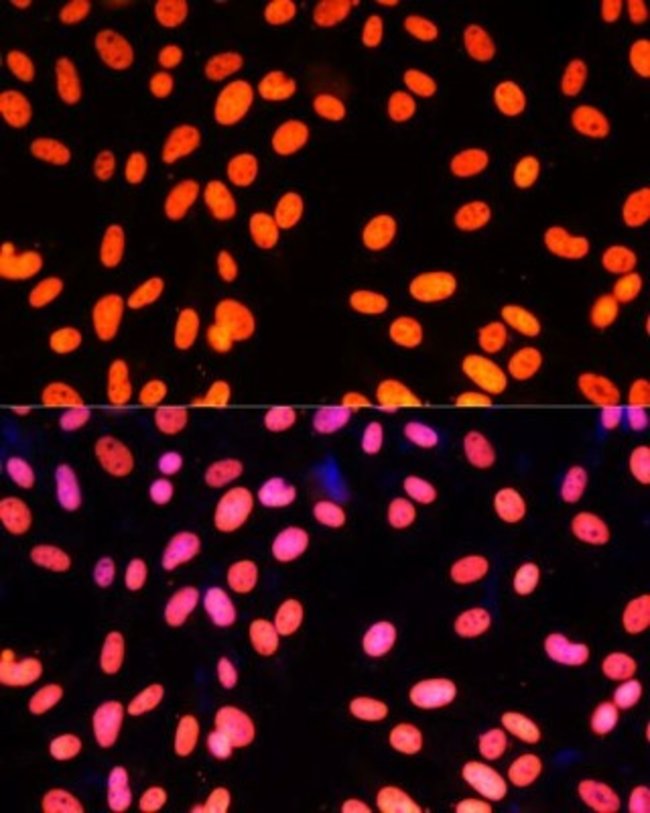 ZINC FINGER PROTEIN 5 - 100 UL