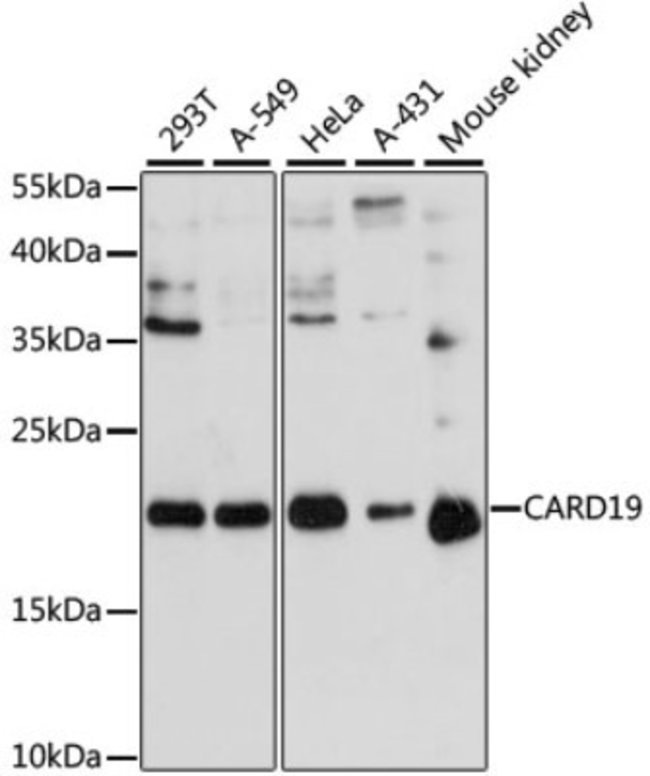 bcl10-interacting CARD protein Rabbit anti-Human, Mouse, Polyclonal ...