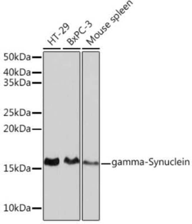 gamma-Synuclein Rabbit anti-Human, Mouse, Rat, Clone: 4A0F4, Novus ...