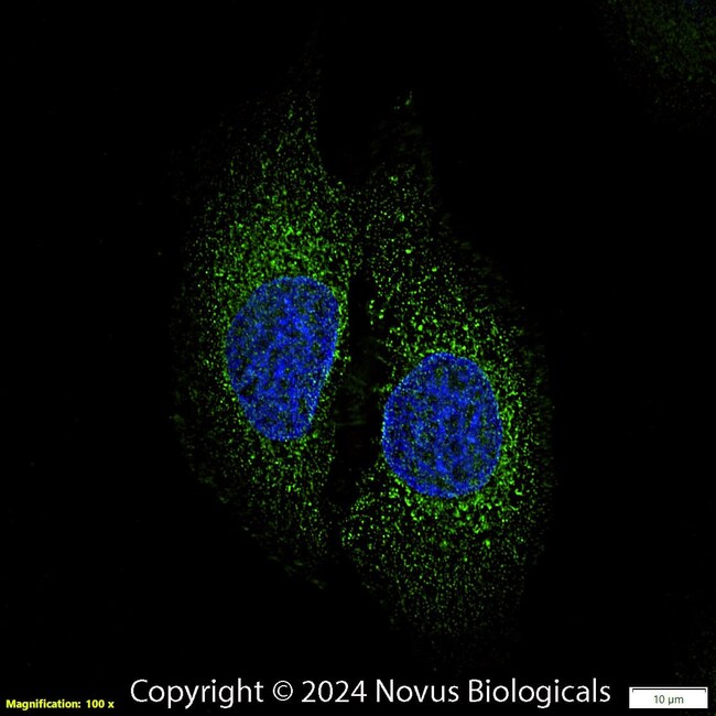 Calreticulin Antibody (1G6A7), Alexa Fluor 488, Novus Biologicals 0.1 ...