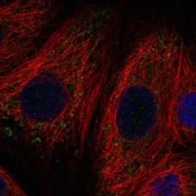 NRAMP1/SLC11A1 Antibody, Novus Biologicals:Antibodies:Primary ...