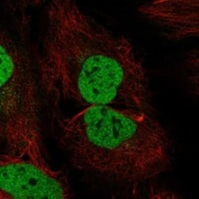 WAPL Antibody, Novus Biologicals:Antibodies:Primary Antibodies | Fisher Scientific