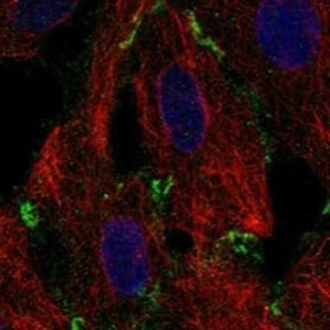 MRP1 Antibody, Novus Biologicals 100 μg; Unconjugated:Antibodies ...
