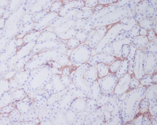 Collagen I Antibody (SR1143), Novus Biologicals 100 μg; Unconjugated ...