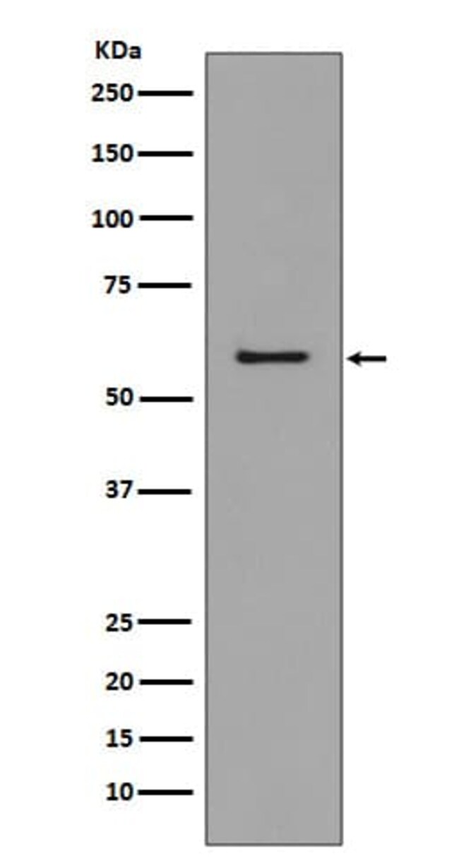 CCR3 Antibody (SR2050), Novus Biologicals 100 μg; Unconjugated ...