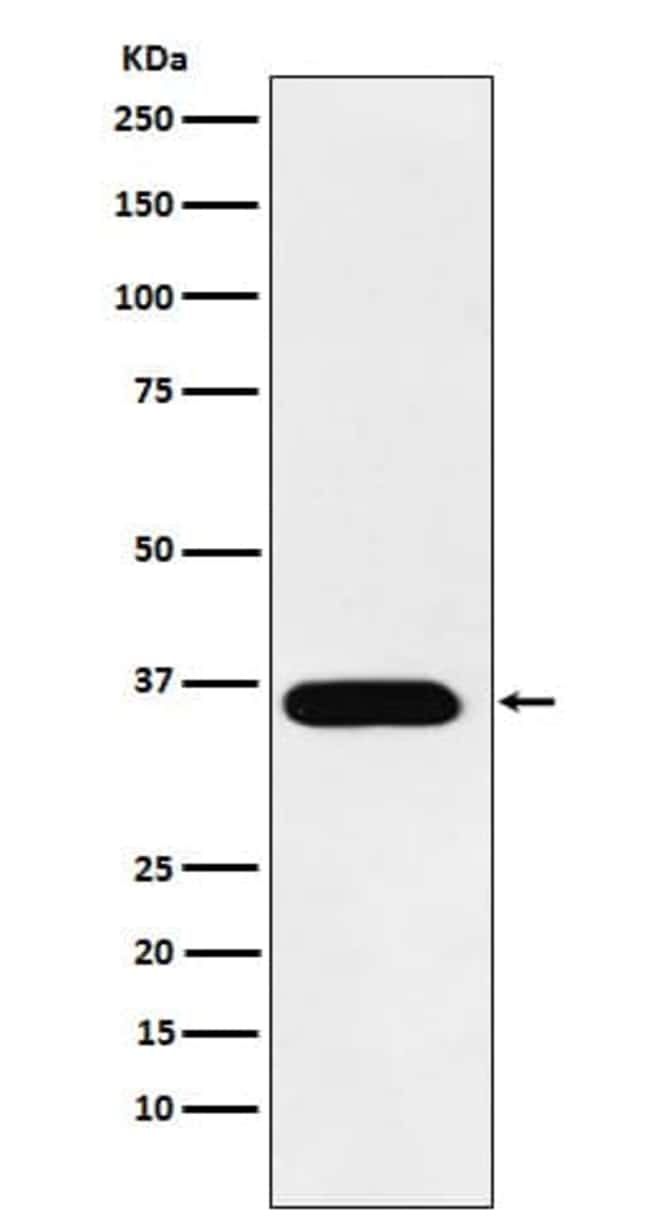 TRACP/PAP/ACP5 Antibody (SR1575), Novus Biologicals 100 μg ...