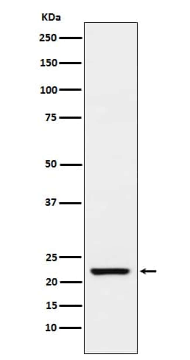 Transgelin/TAGLN/SM22 alpha Antibody (SR1369), Novus Biologicals 100 μg ...
