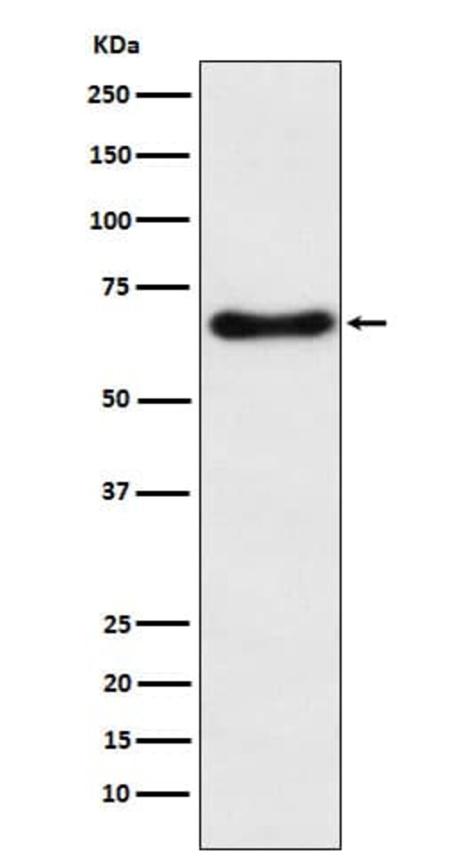 CYP24A1 Antibody (SR2038), Novus Biologicals 50 μg; Unconjugated ...