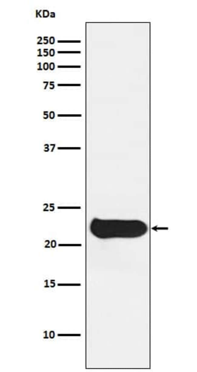 Glutathione Peroxidase 2/GPX2 Antibody (SR1346), Novus Biologicals 50 ...
