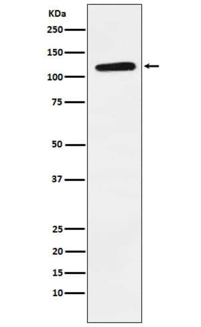 EphB1 Antibody (SR1093), Novus Biologicals 50 μg; Unconjugated ...