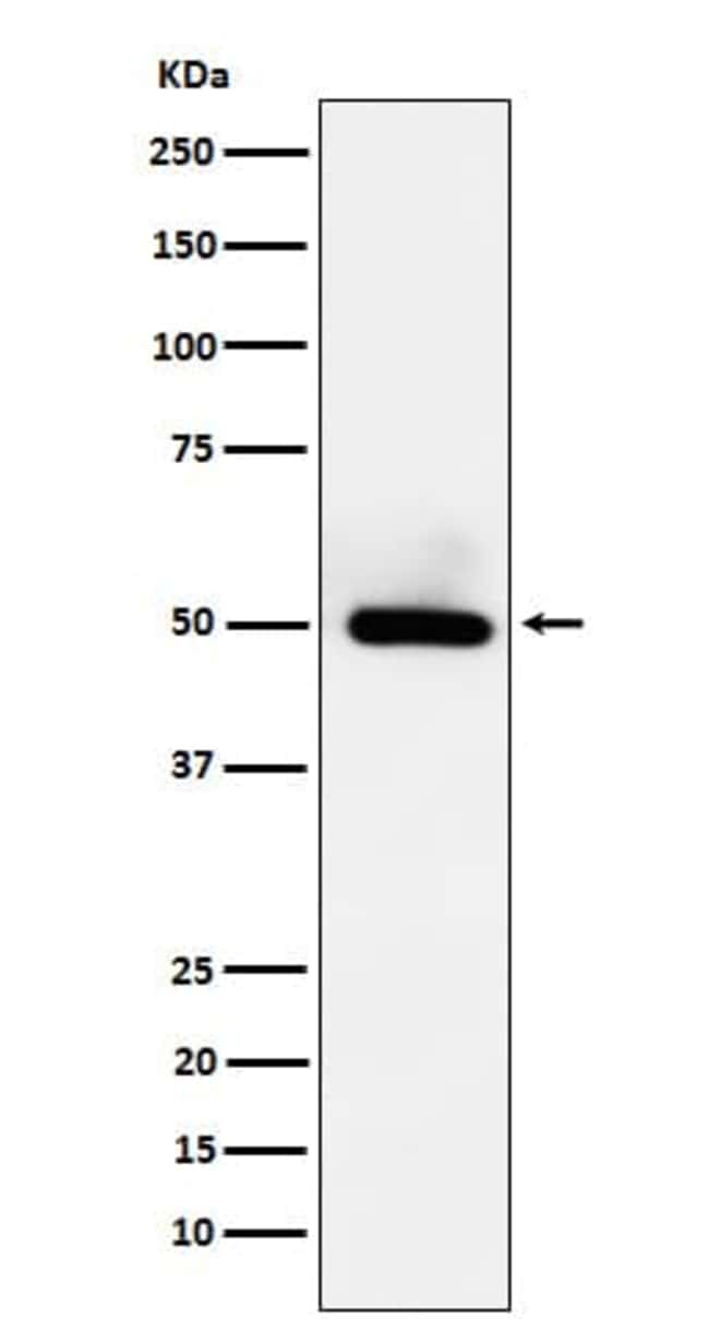BMP-15/GDF-9B Antibody (SR1868), Novus Biologicals 100 μg; Unconjugated ...