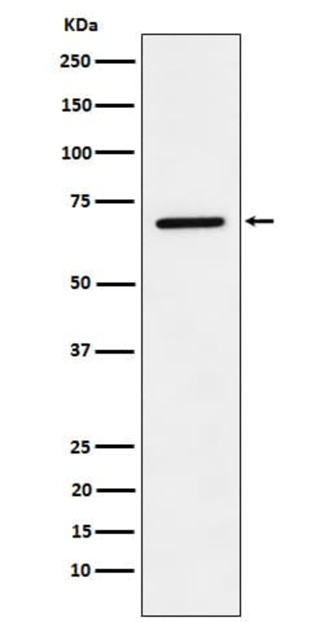 Leukotriene A4 Hydrolase/LTA4H Antibody (SR2135), Novus Biologicals 50 ...