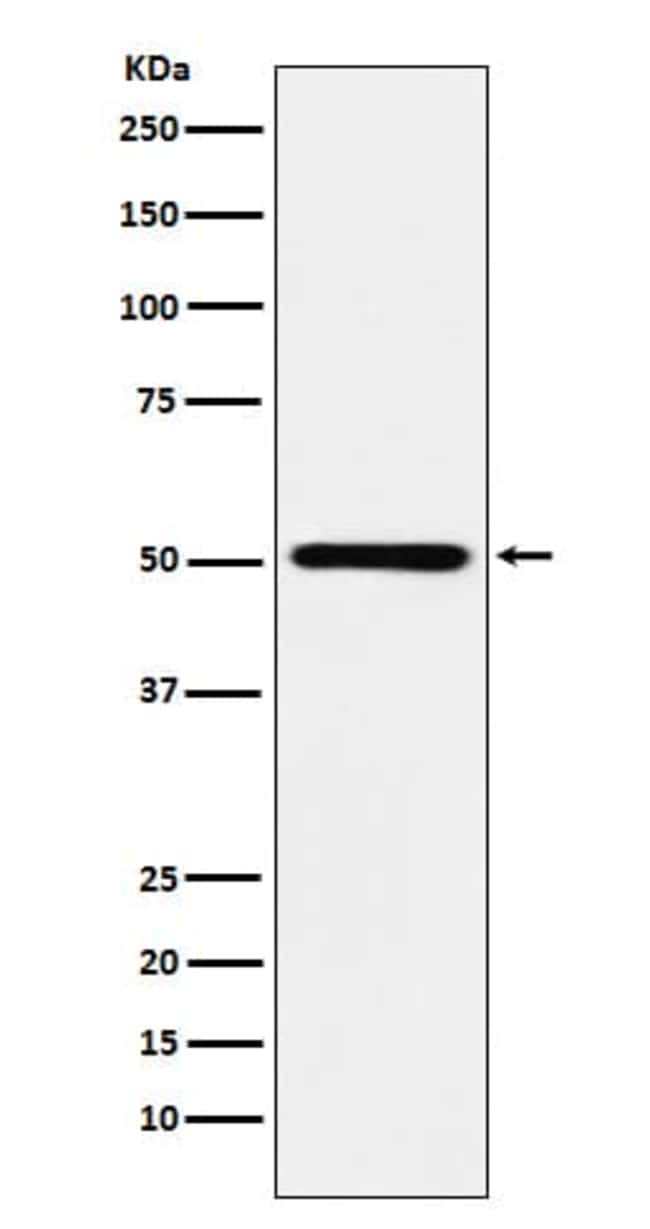 RING1 Antibody (SR1892), Novus Biologicals 100 μg; Unconjugated ...