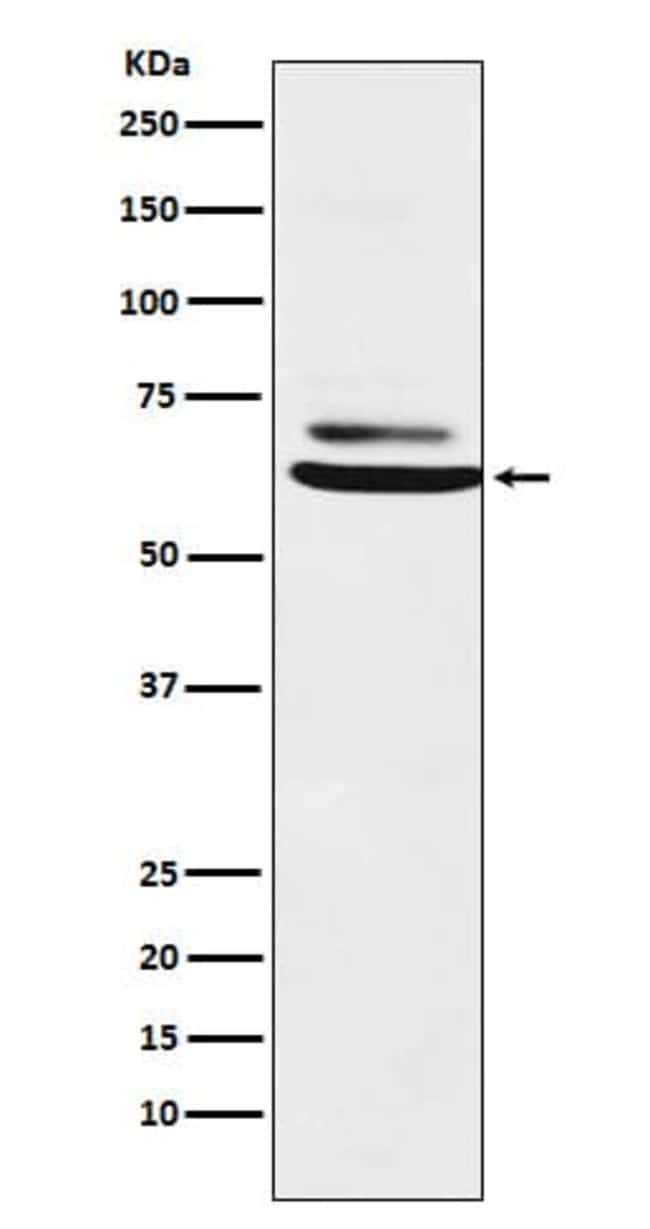ENT2 Antibody (SR1973), Novus Biologicals 50 μg; Unconjugated ...