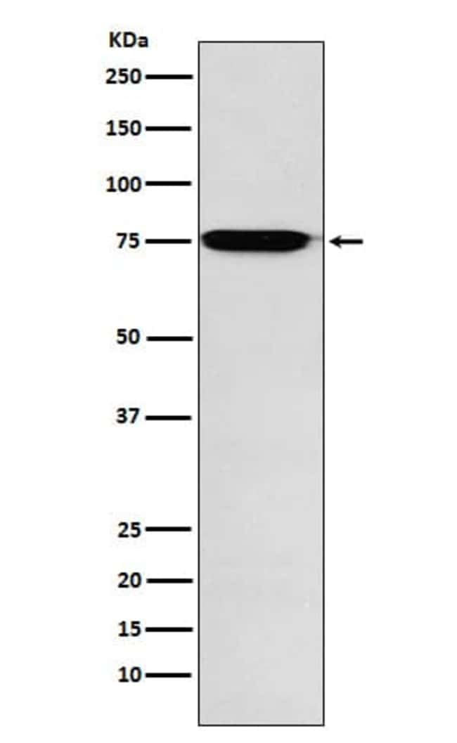 LYAG/GAA Antibody (SR1086), Novus Biologicals 100 μg; Unconjugated ...