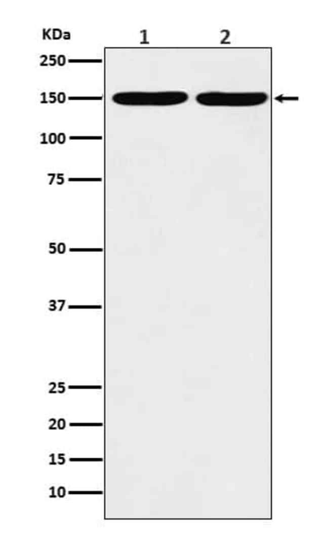 Collagen III alpha 1/COL3A1 Antibody (SR1186), Novus Biologicals 100 μg ...