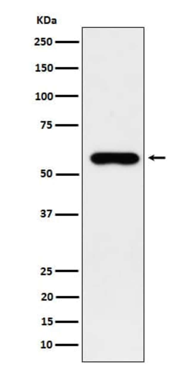 SUOX Antibody (SR2065), Novus Biologicals 100 μg; Unconjugated ...